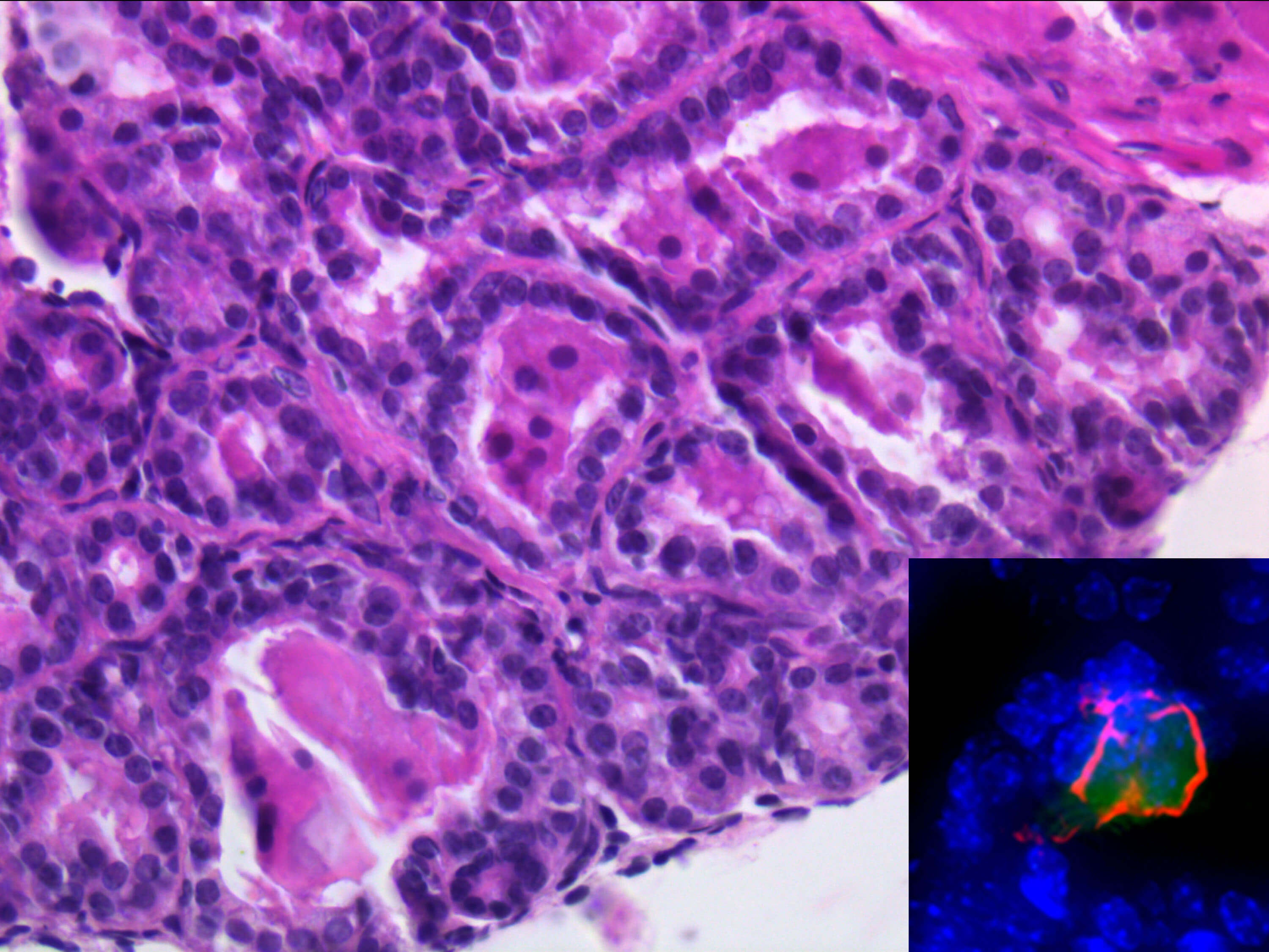 Researchers discover a common parasite can infect and promote disease ...