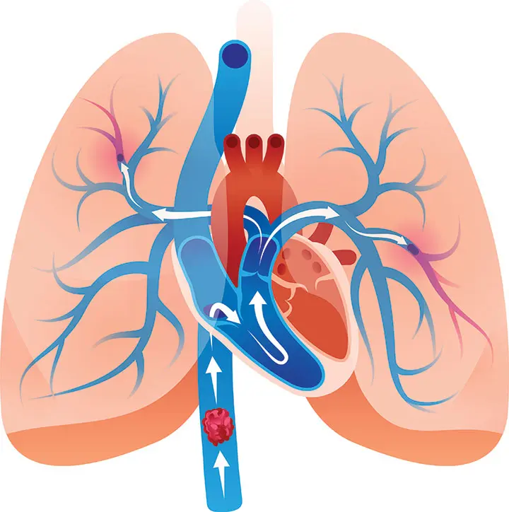Research | Krannert Cardiovascular Research Center | IU School of Medicine