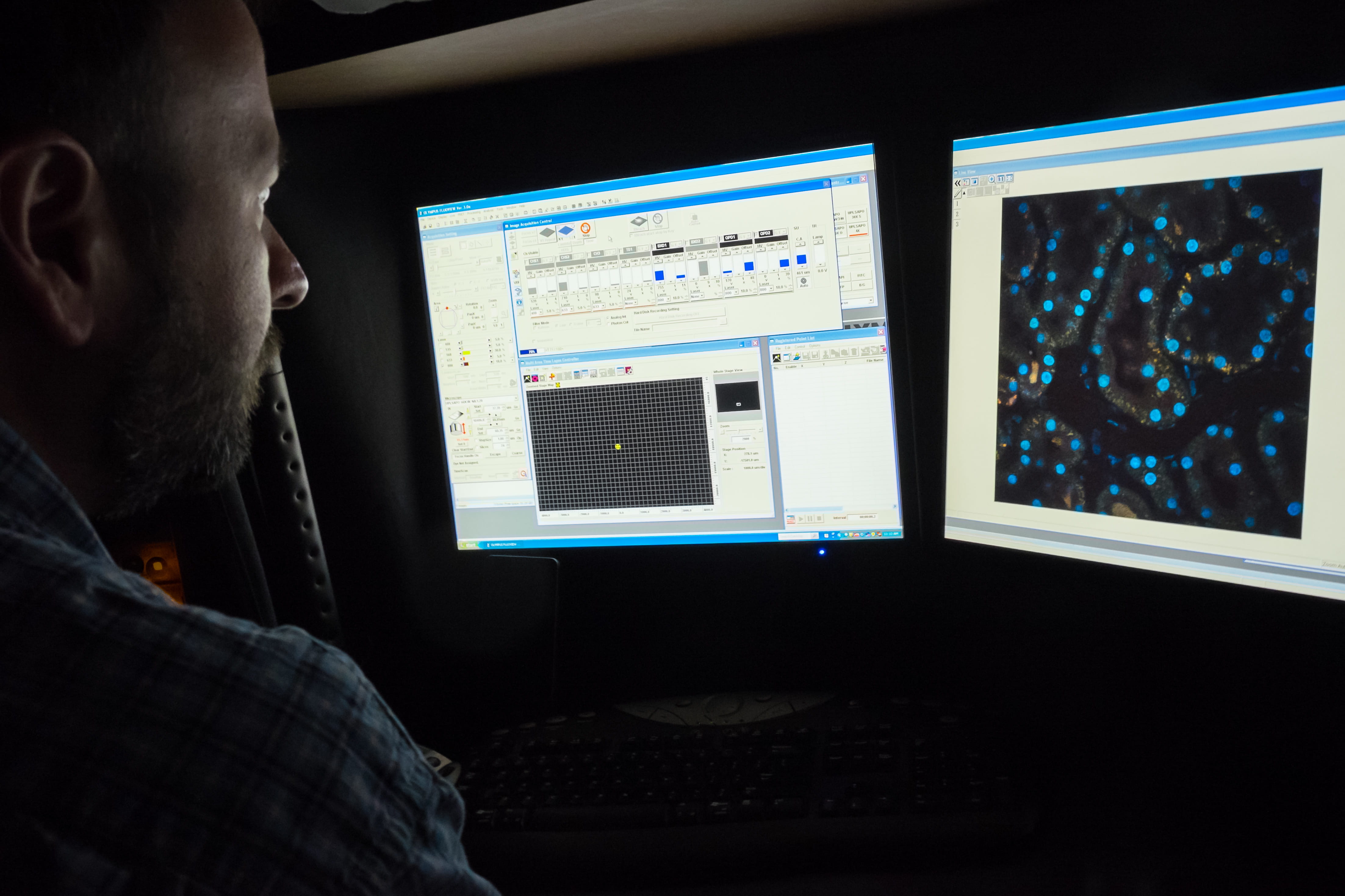 IU School of Medicine announces multi-million-dollar research agreement ...
