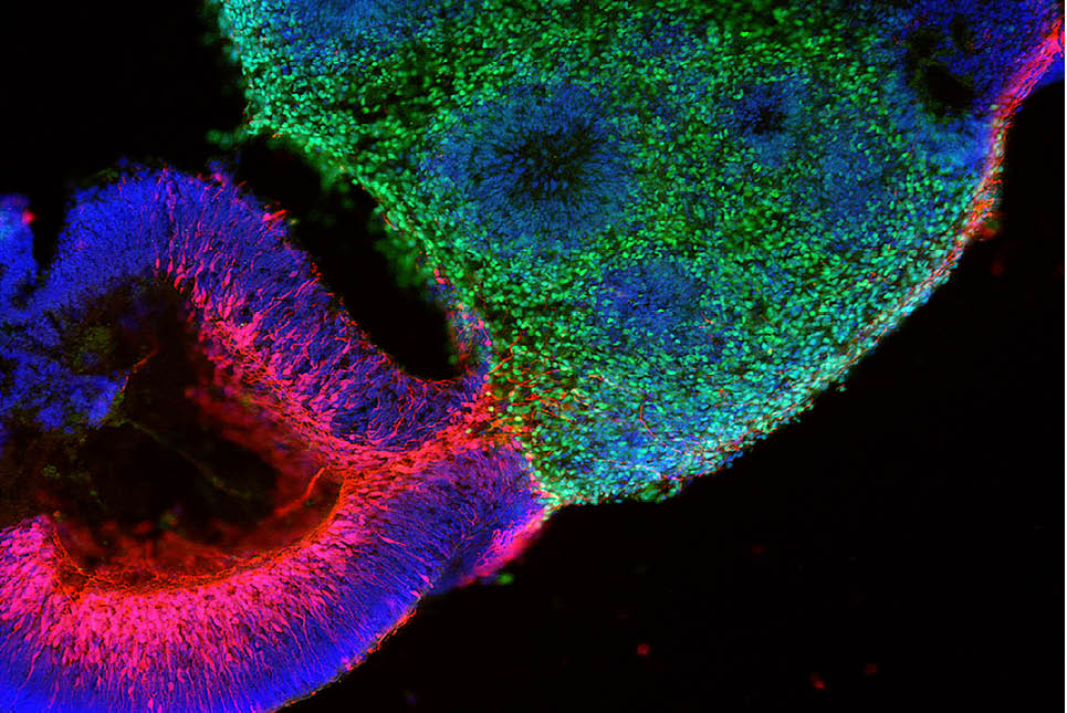 Researchers develop human cellular model of visual pathway in a dish